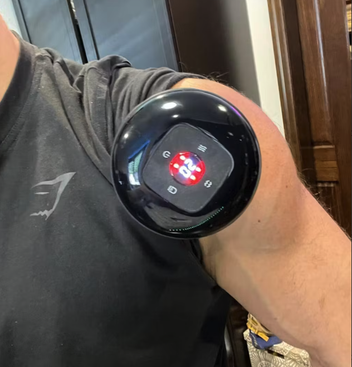 Renoheal Cupping Massager – Shrine Regular Demo