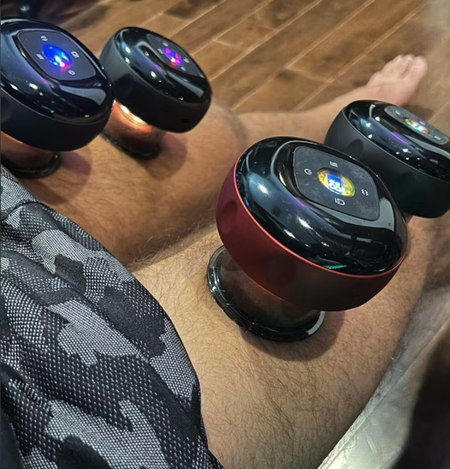 Renoheal Cupping Massager – Shrine Regular Demo