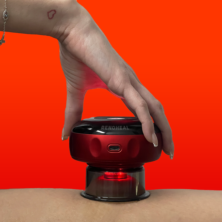 Renoheal Cupping Massager – Shrine Regular Demo